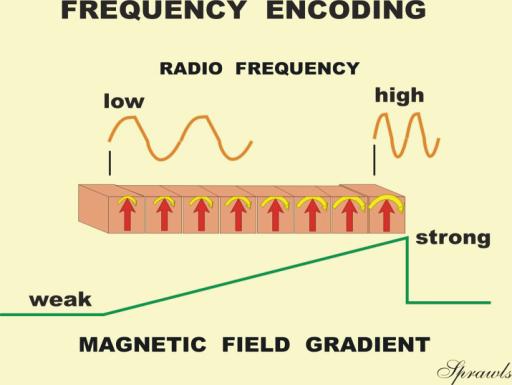 Magnetic Resonance Imaging